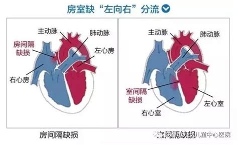先心宝宝症状图片 婴儿紫绀图片 先心宝宝紫钳图片 大山谷图库