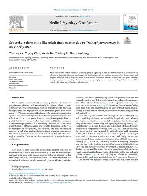 Pdf Seborrheic Dermatitis Like Adult Tinea Capitis Due To