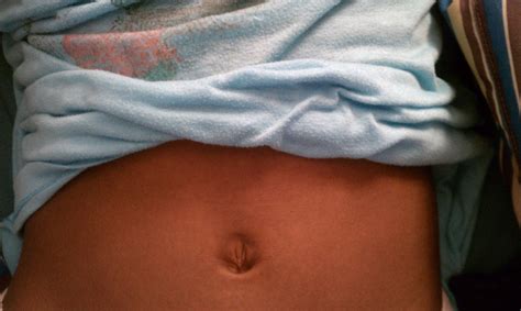 Belly Buttons Outie