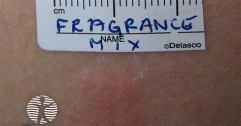 Patch Test Image