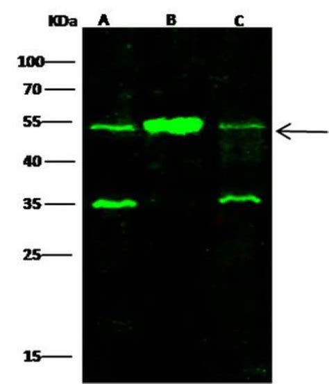 SETD7 Monoclonal Antibody 19 Invitrogen 100 μL Unconjugated