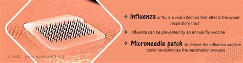 Microneedle Patch To Deliver Influenza Vaccine A Peek Into The Future