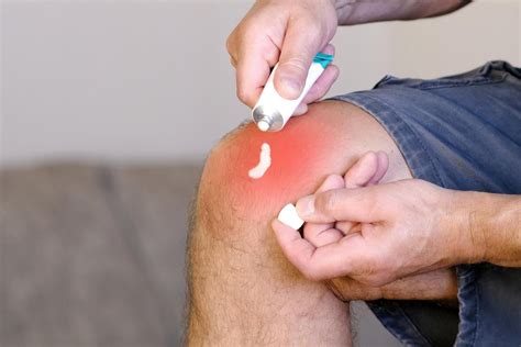 Gentamicina Crema A Cosa Serve E Altre Domande Frequenti