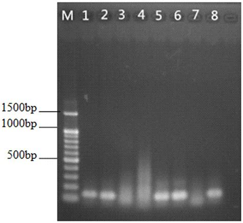 Rapid And Efficient Screening Method For Microcystins Degrading Bacterium Eureka Patsnap