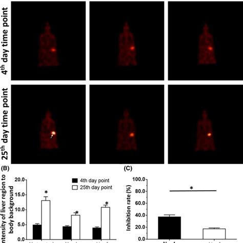The Inhibitory Effect Of Sorafenib On The Intrahepatic Growth Of