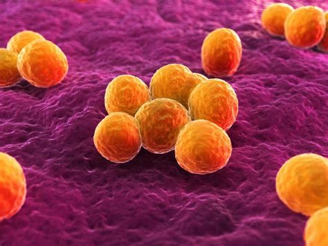 Outcomes Of Vancomycin Plus Ceftaroline Salvage Therapy In Patients
