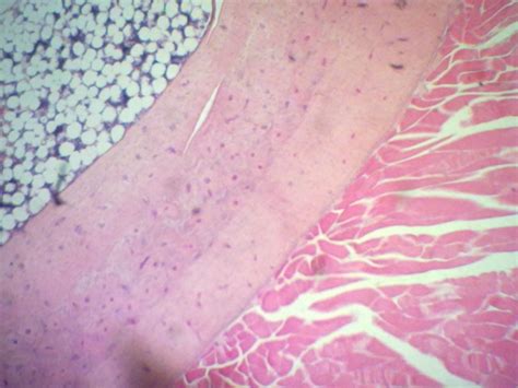 Bone Howmed Images