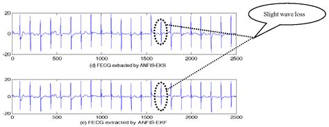 Sensors Free Full Text Single Lead Fetal Ecg Extraction Based On A Parallel Marginalized