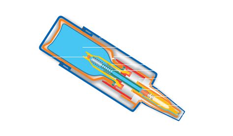 Sistemul Comod Ce Diferențe Există între El și Restul Hylo Ro