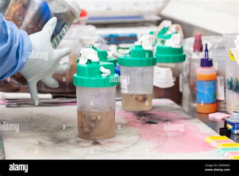 Biopsy Samples Being Processed At The Pathology Laboratory To Be