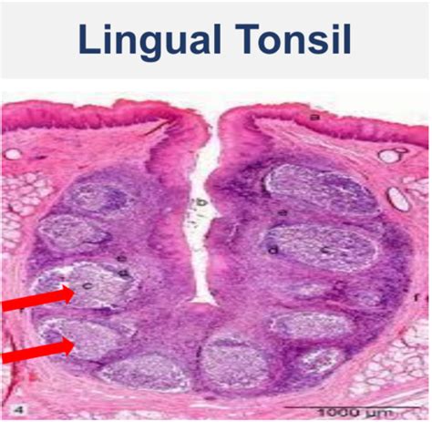 Lingual Tonsil Histology