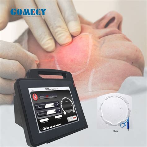 Optical Fiber Endolaser Lift 1470nm 980nm Diode Laser Face Lifting