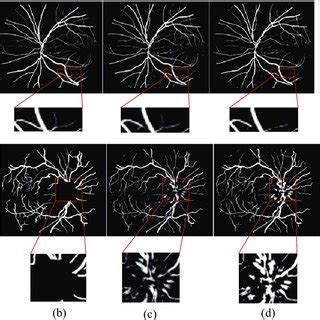 Visual Comparison Of Segmentation Results On CHASE Dataset Column A