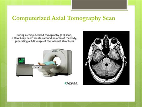 Ppt Mri Cat Scan Concussions Powerpoint Presentation Free Download