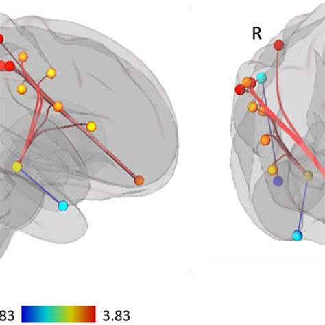 Betweengroup Differences In Regiontoregion Functional Connectivity