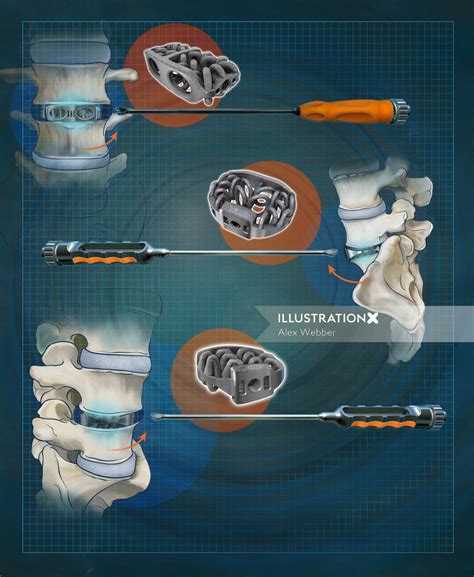 Alex Webber Medical And Scientific Illustrator Usa