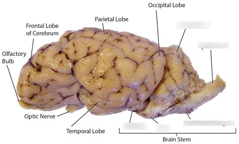 Sheep Brain Lateral View Diagram Quizlet