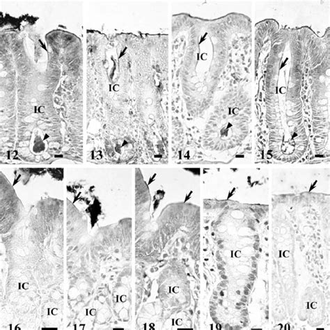 Cytoplasm Of Epithelial Cell At The Middle To Apical Portions Of The