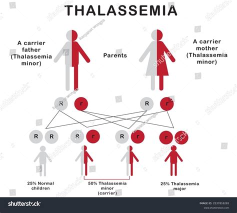 Vektor Stok Diagram Talasemia Menunjukkan Bagaimana Talasemia Diwarisi