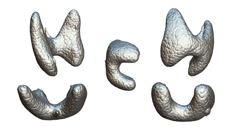 3d File Healthy Thyroid And Thyroid Cancer ♋・3d Print Model To Download