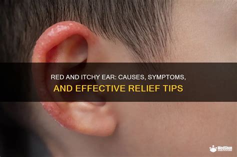 Red And Itchy Ear Causes Symptoms And Effective Relief Tips Medshun