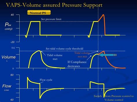 Class Learning In Ventilator Mode