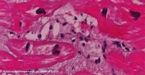 Horizon On Linkedin Oh The Places Urate Will Go Evolution Of Gout