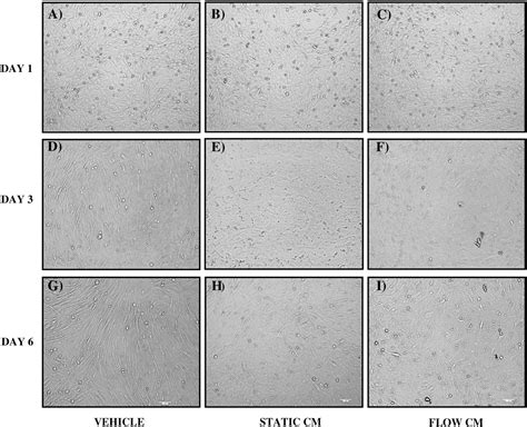 Figure 1 From Osteocyte Secreted Factors Inhibit Skeletal Muscle Differentiation Semantic Scholar