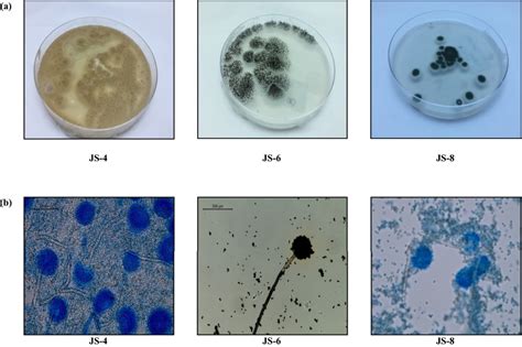 Macroscopic A And Microscopic B Features Of Fungal Isolates