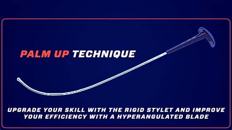 Hyperangulated Video Laryngoscopy Palm Up Technique Youtube