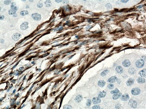 Vimentin Mouse Anti Human Mouse Rat Clone 3h9d1 Proteintech 20 μl