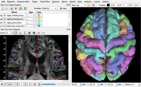 How To Analyze Dmri Dsi Studio Documentation