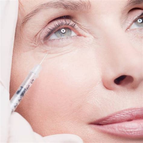 Jelly Roll Botox® Under Eye Fixes Iapam