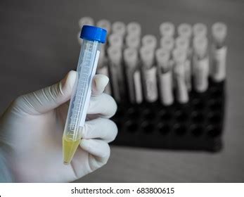 Body Fluid Images Stock Photos Vectors Shutterstock