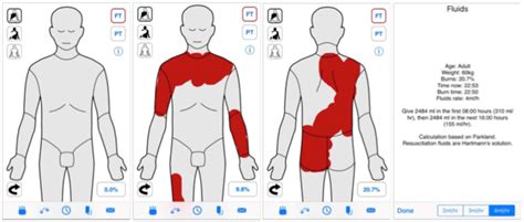Major Trauma Burns Rcemlearning