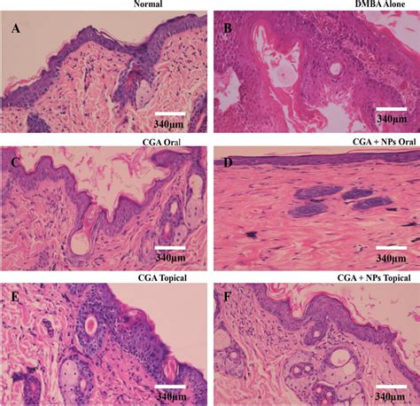 Histopathological Features Observed In Experimental Mice A