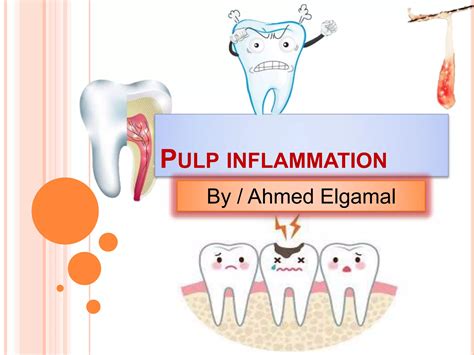 Dental Pulp Inflammation Causes And Types Ppt