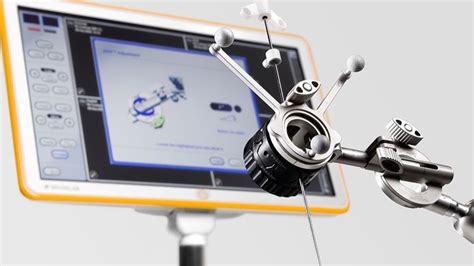 Advancements In Neuro Navigation Systems Revolutionizing Brain Surgeries