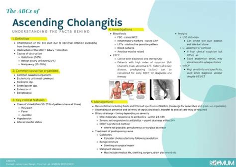Abcs Of Ascending Cholangitis Surgical Interest Group Of Monash University Malaysia