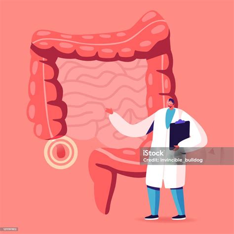 아픈 부록 인포그래픽이 있는 인간 창자에 서 있는 의사 또는 의학 교사 캐릭터는 치료 전략을 결정합니다 복통 위장 시스템 질환