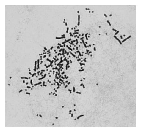 Karyotype Analysis Of Wysm Cells A Cellular Chromosome Of Wysm Cells