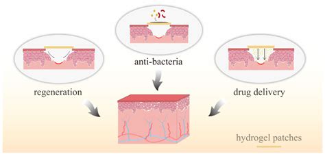 Hydrogels For Oral Tissue Engineering Challenges And Opportunities Pmc
