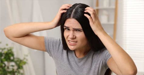 Gljivice Na Glavi Uzroci Simptomi I Rešenja Ovotaris