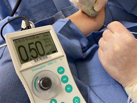 Ultrasound Guided Regional Anesthesia For Improved Ne