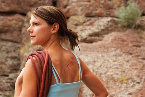 Erasing Scars Methods Products That Can Help Fade Scars Faster