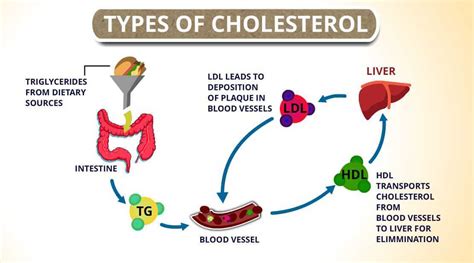 Hdl Vs Ldl