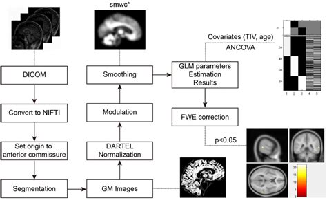Frontiers Decreased Gray Matter Volume In The Right Middle Temporal