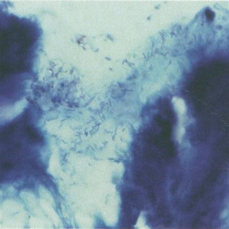 Age And Sex Distribution Of 6977 Endoscopy Patients Download