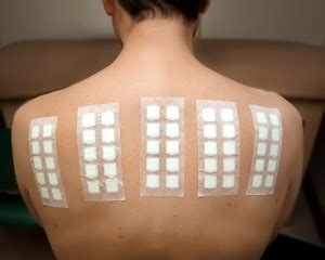 Contact Dermatitis Asthma And Allergy Affiliates