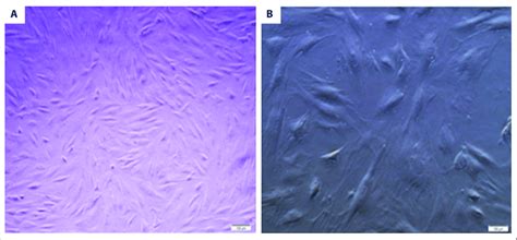 Isolation Culture And Morphological Identification Of Adipose Derived